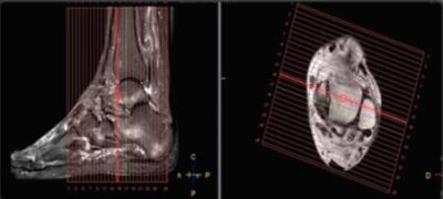 Protocolo de Tobillo en Resonancia Magnética | Paso a paso