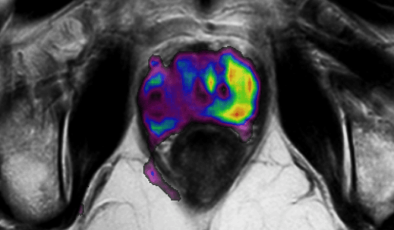 Acelerador lineal (LINAC) en oncología. El Futuro está aquí